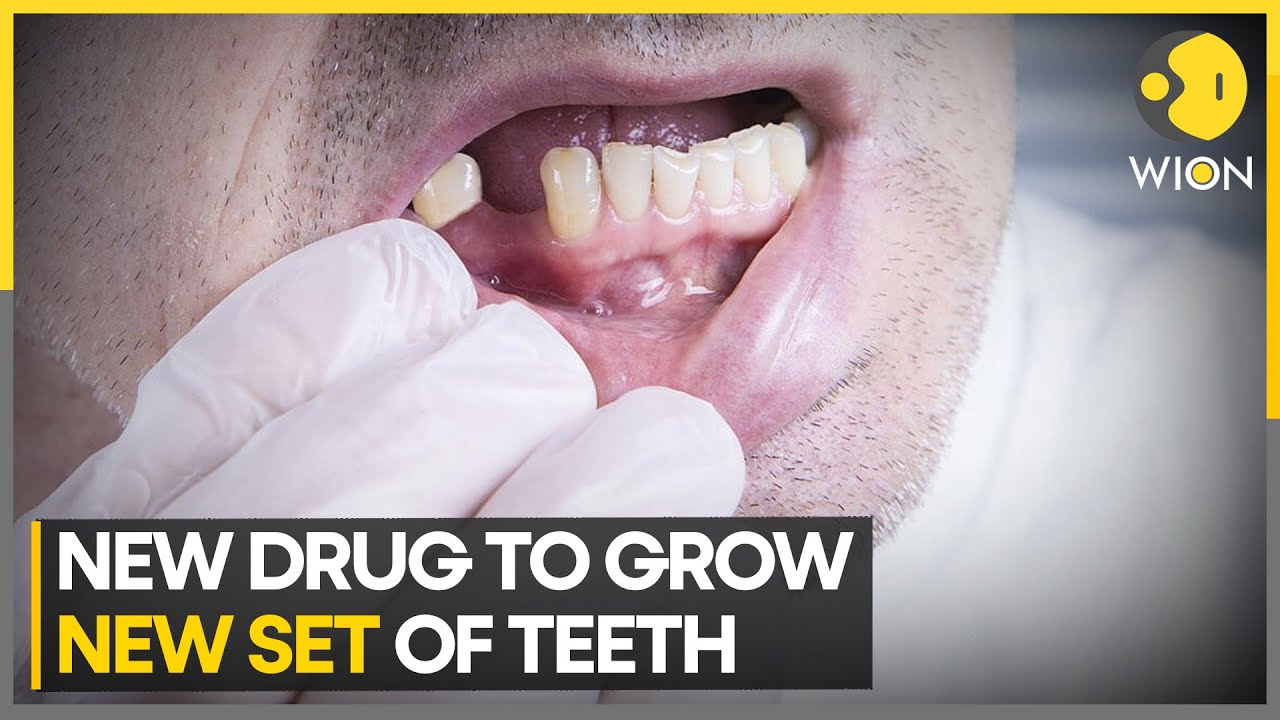 Japanese Scientists Develop Groundbreaking Drug That Grows New Teeth ...